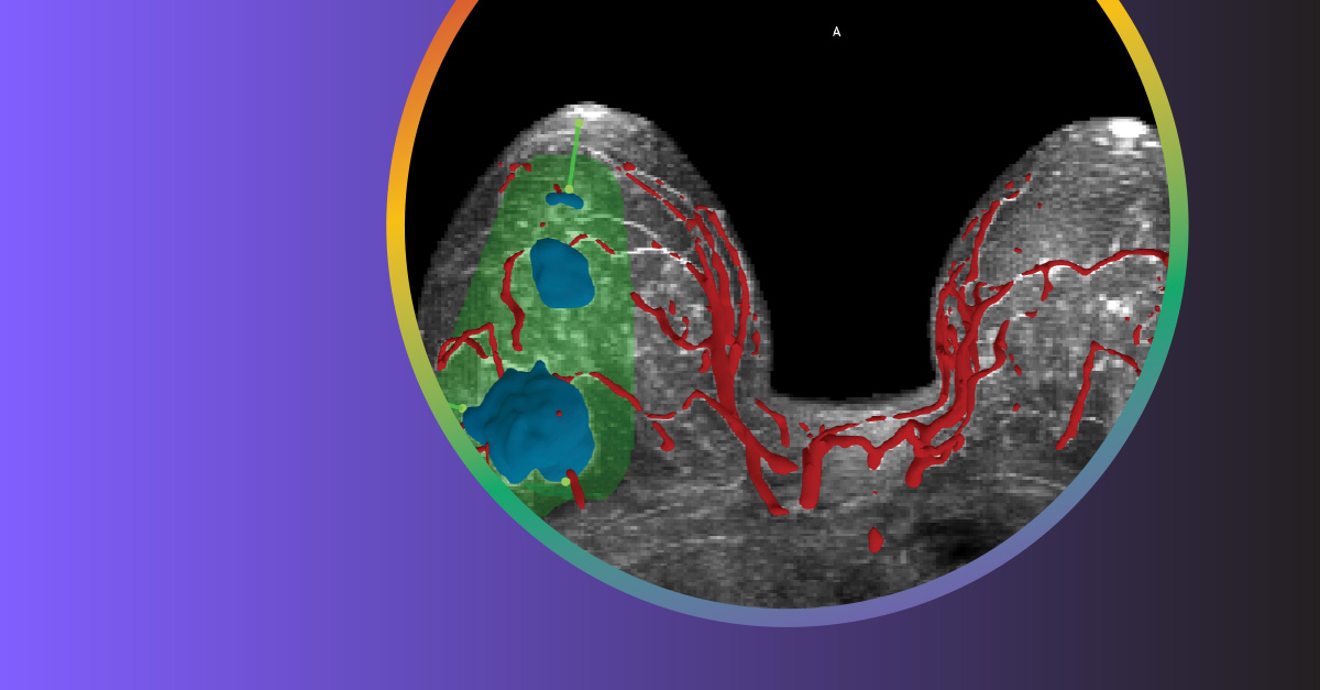 AI-powered 3D Visualization | TumorSight™ Viz | Webinar | Ricoh USA