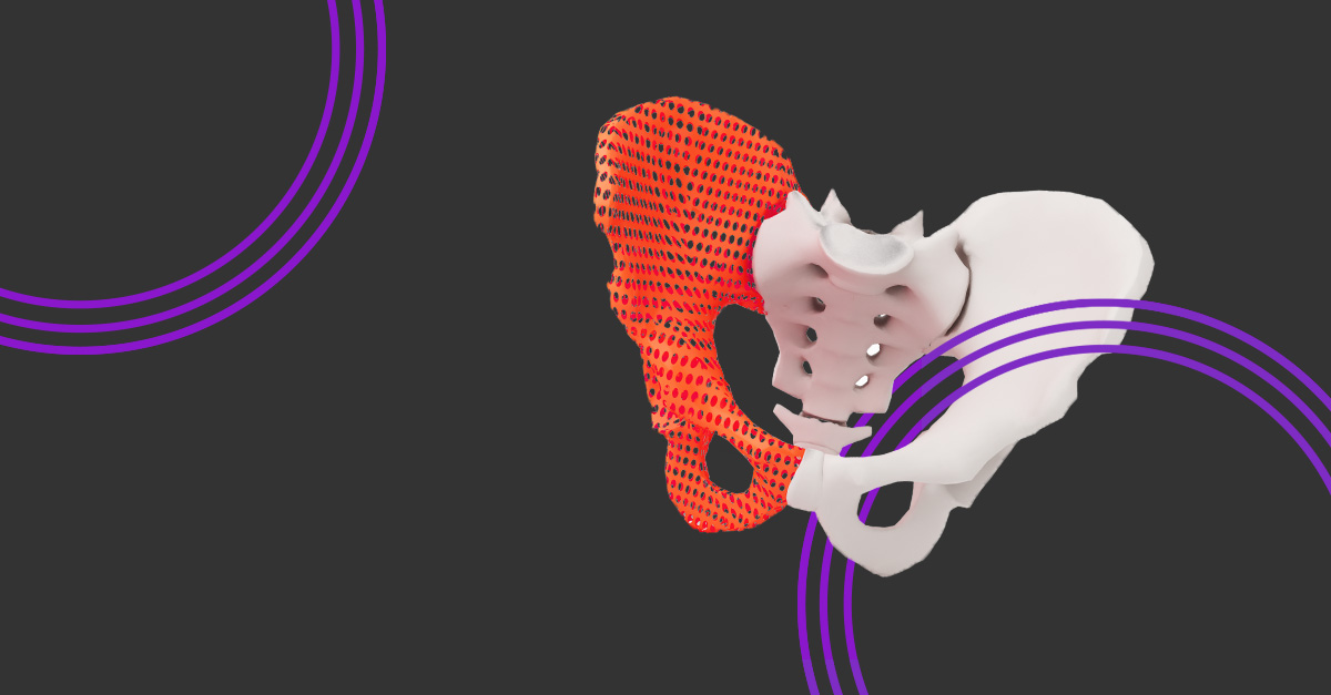 RICOH 3D Medical Models Printing in Healthcare | Ricoh USA